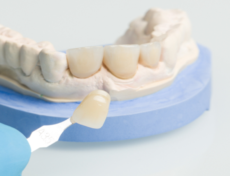 A Comprehensive Guide to Dentures - SmiLee Dental